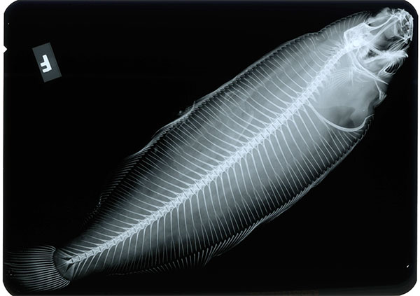 갈가자미(Willowy flounder). Glyptocephalus kitaharae